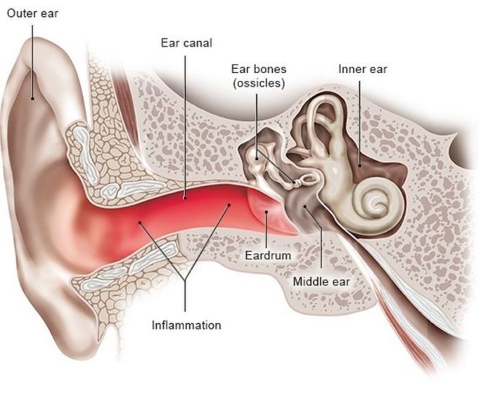 A Guide to External Ear Infections from an ENT Specialist in Singapore ...