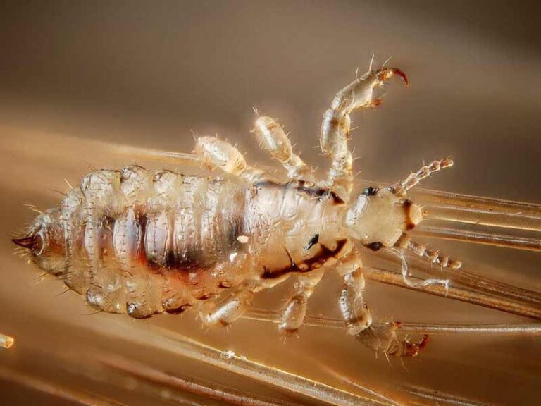 Some Lice Symptoms You Need to Be Aware Of - Health Life and Recipes