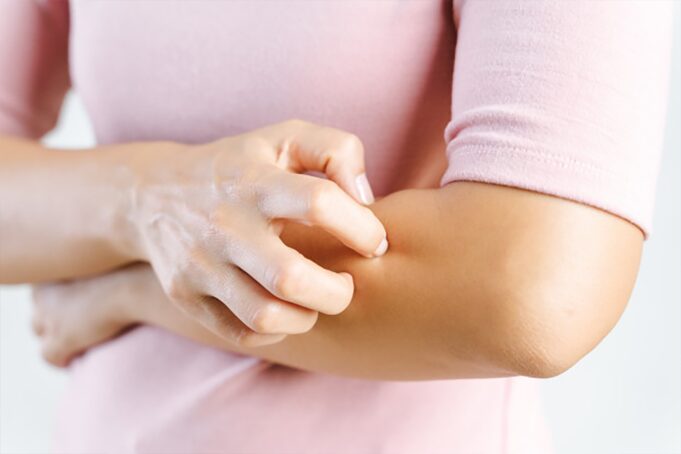 How to Avoid Skin Allergies from Laundry - Health Life and Recipes
