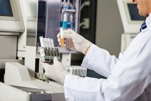 How Fast Lab Testing Can Help You Recover Quickly - 4 Step Procedure ...